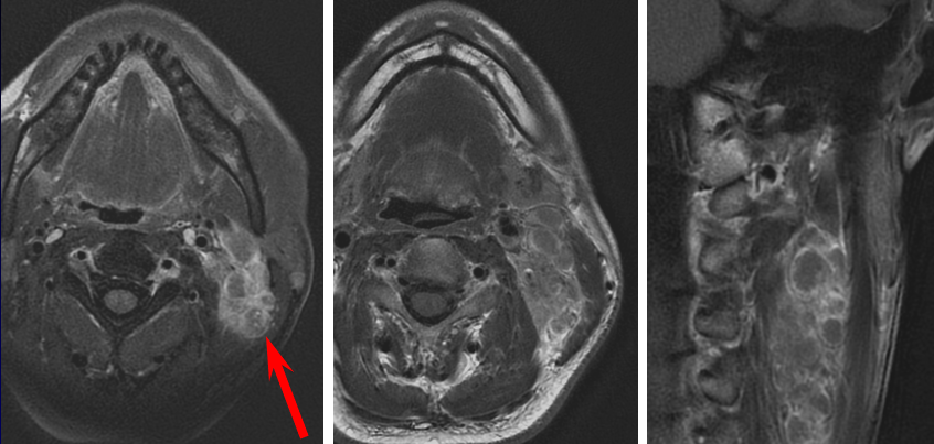 Round 3: Complex Cases and Borderline Cases - IENE